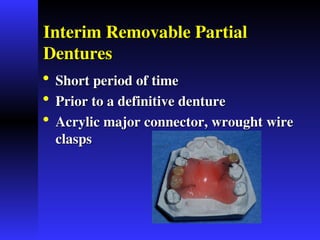 nature and usage of Interim Removable Partial Dentures | PPT
