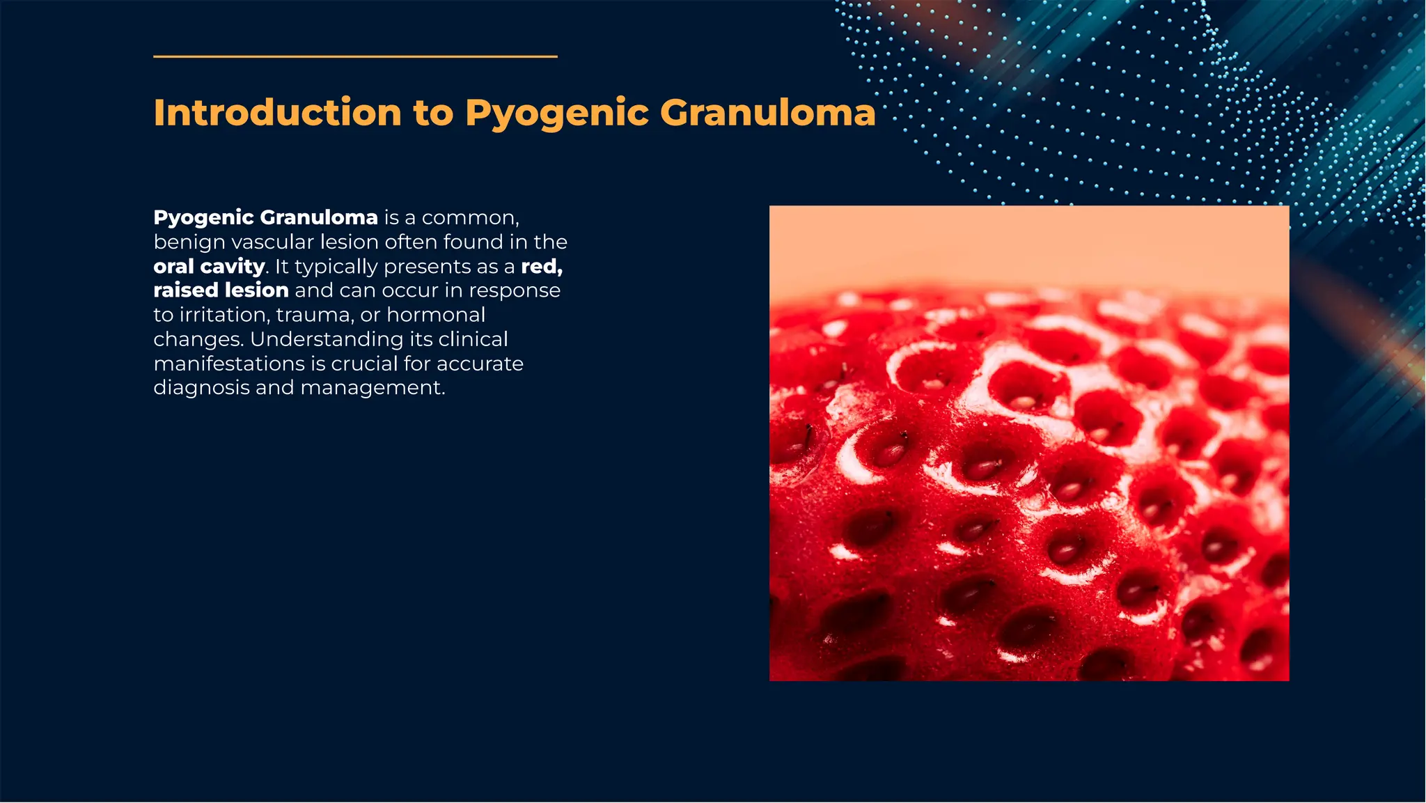 clinical insights into oral cavity manifestation of Pyogenic Granuloma.pdf