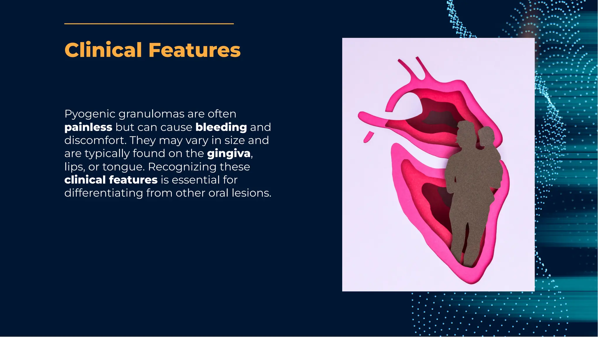 clinical insights into oral cavity manifestation of Pyogenic Granuloma.pdf