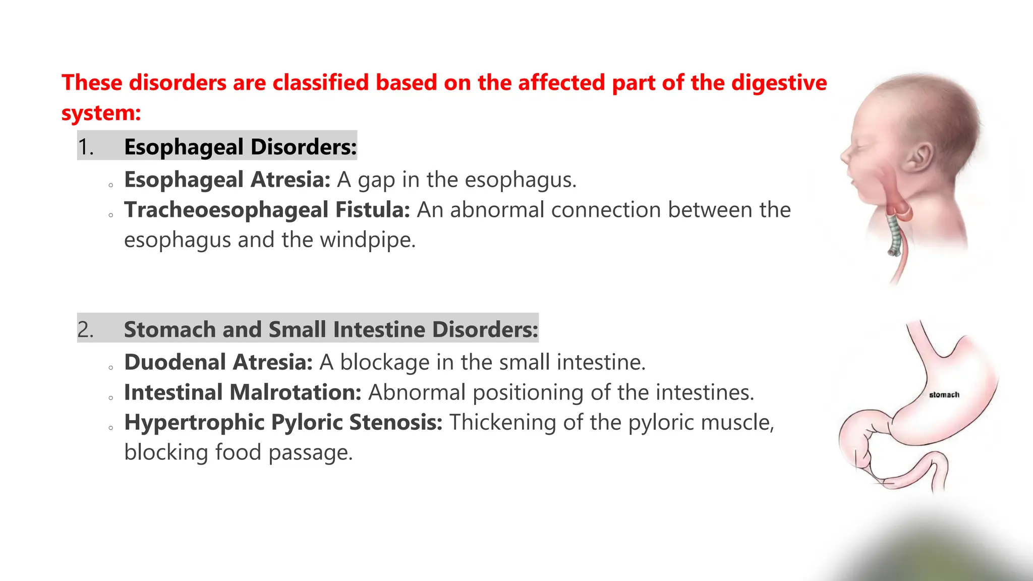 Congenital digestive system diseases and disturbances | PDF