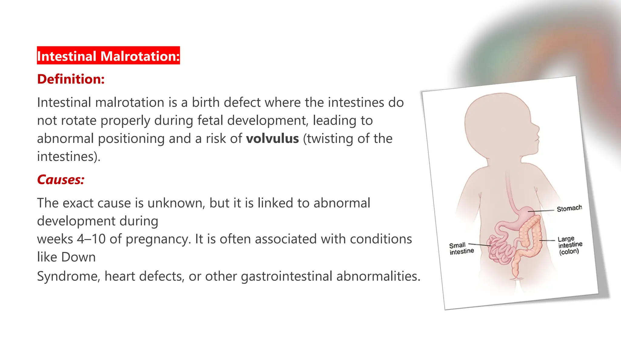 Congenital digestive system diseases and disturbances | PDF