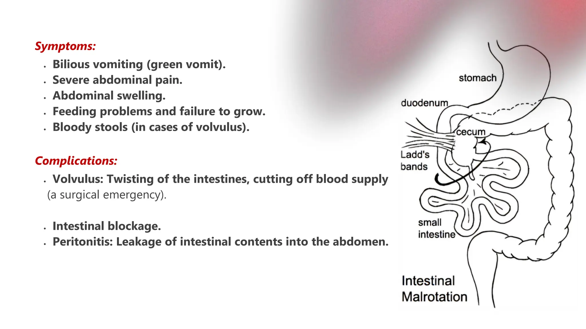 Congenital digestive system diseases and disturbances | PDF