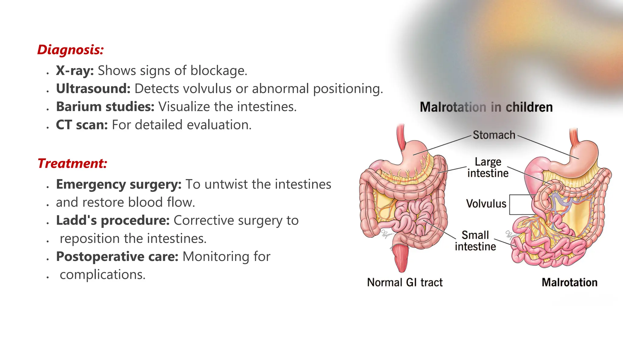 Congenital digestive system diseases and disturbances | PDF