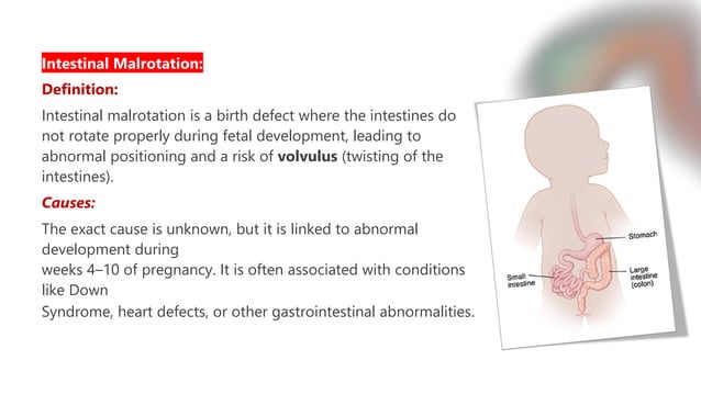 Congenital digestive system diseases and disturbances | PDF