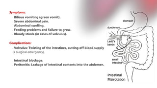 Congenital digestive system diseases and disturbances | PDF
