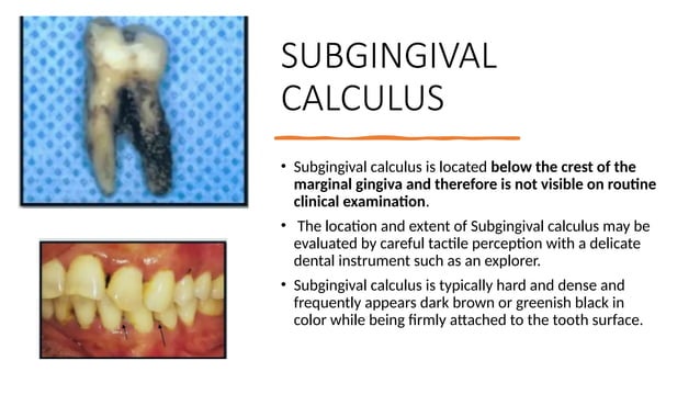 13.Calculus-and-Theories-of-calculus-formation-.pptx