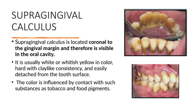 13.Calculus-and-Theories-of-calculus-formation-.pptx