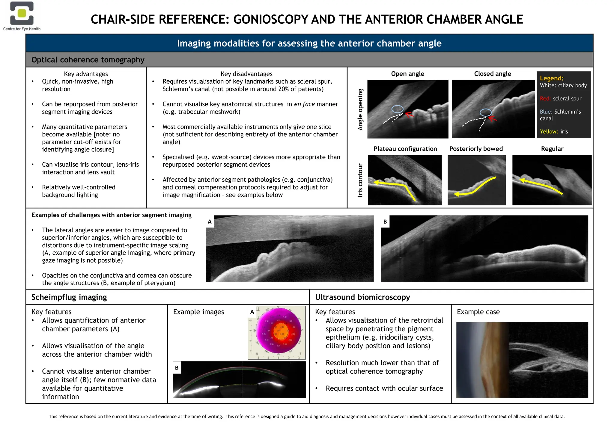 13. Gonioscopy-and-anterior-chamber-angle.pdf