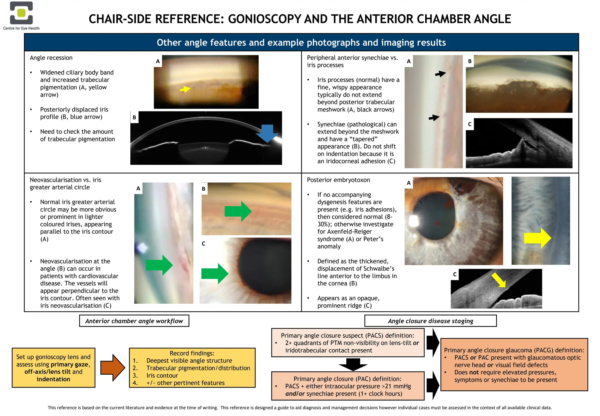 13. Gonioscopy-and-anterior-chamber-angle.pdf