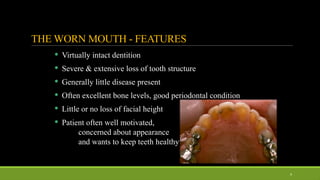 13. FULL MOUTH REHABILITATION in severly attrited dentition | PPTX