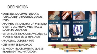 FERULA DE INMOVILIZACION para traumatologia.pptx