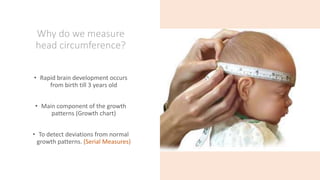 Abnormal head size | PPTX