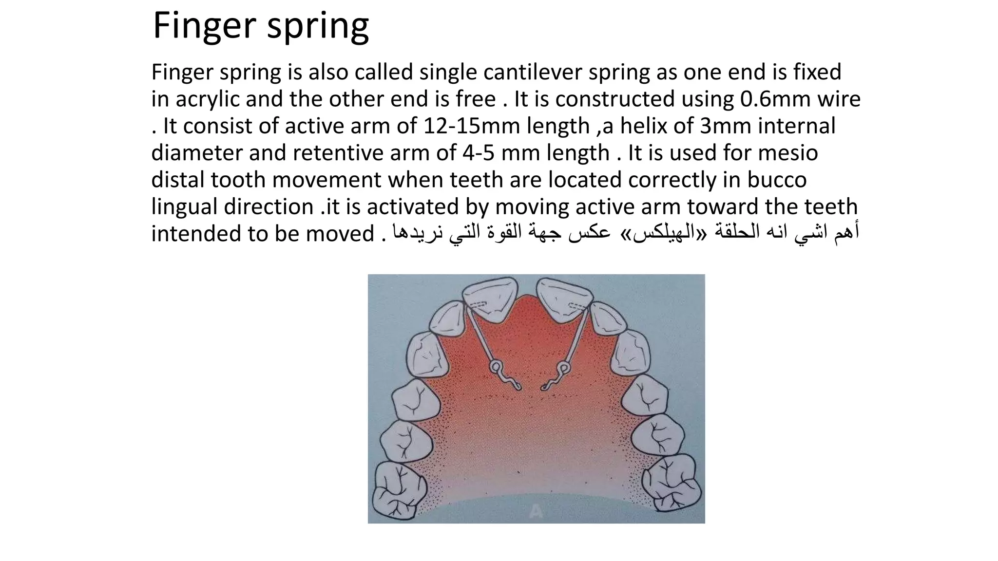Orthodontics Removable appliances ch17 | PPTX