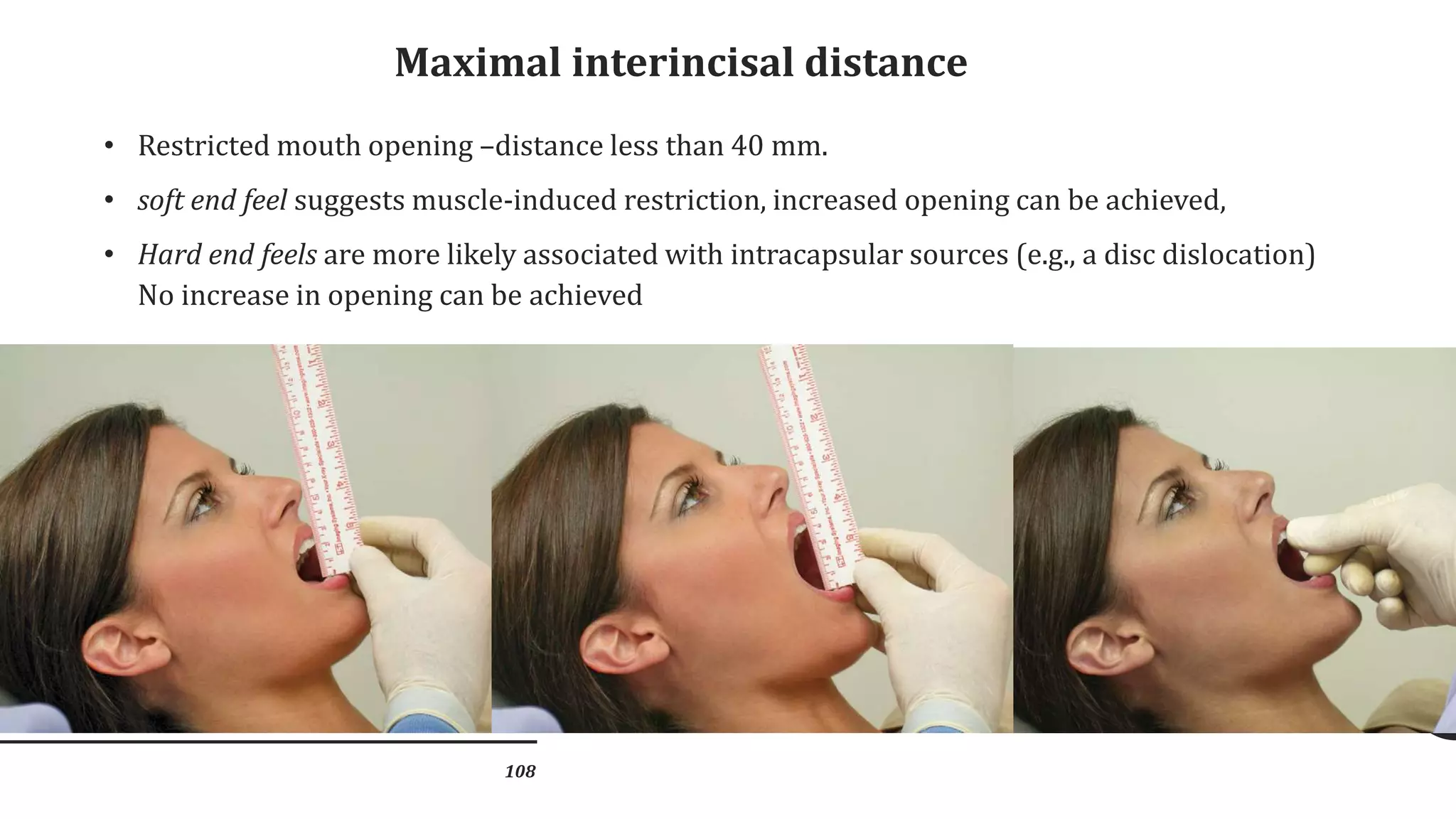 Diagnosis of temporomandibular disorders- Kelly | PPTX