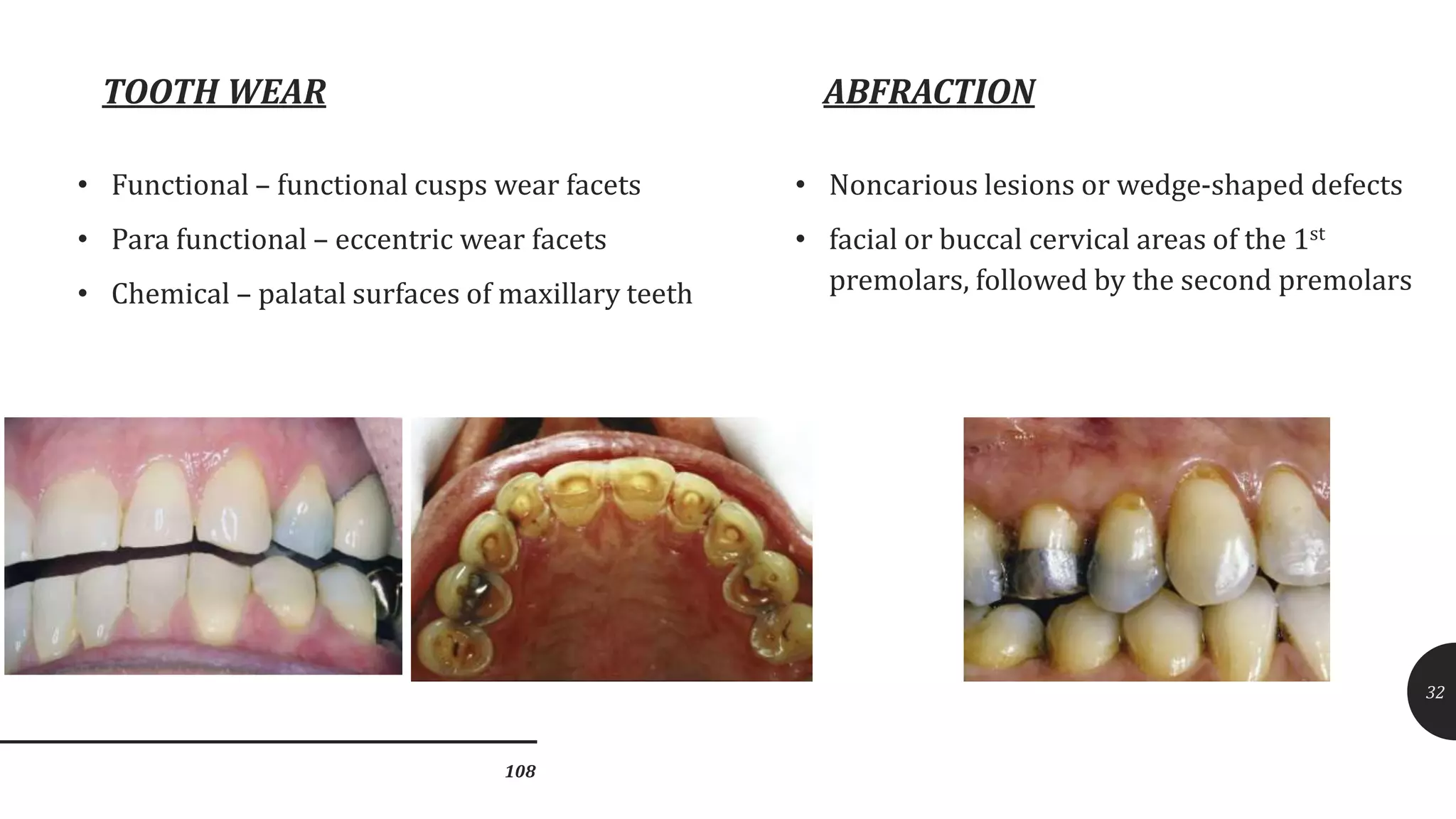 Diagnosis of temporomandibular disorders- Kelly | PPTX