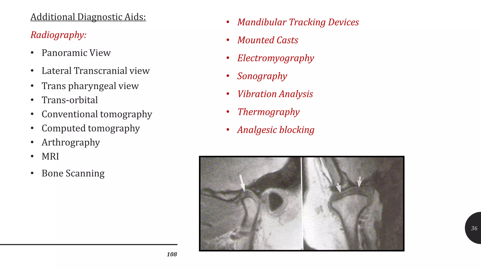 Diagnosis of temporomandibular disorders- Kelly | PPTX
