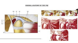 Diagnosis of temporomandibular disorders- Kelly | PPTX