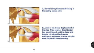 Diagnosis of temporomandibular disorders- Kelly | PPTX