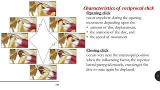 Diagnosis of temporomandibular disorders- Kelly | PPTX