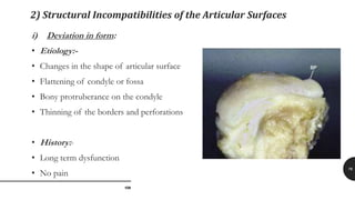 Diagnosis of temporomandibular disorders- Kelly | PPTX