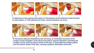 Diagnosis of temporomandibular disorders- Kelly | PPTX