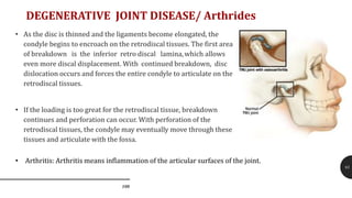 Diagnosis of temporomandibular disorders- Kelly | PPTX