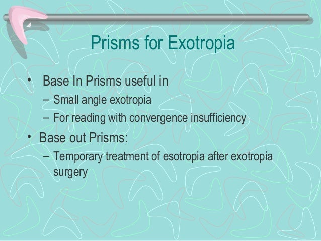 13 exotropia