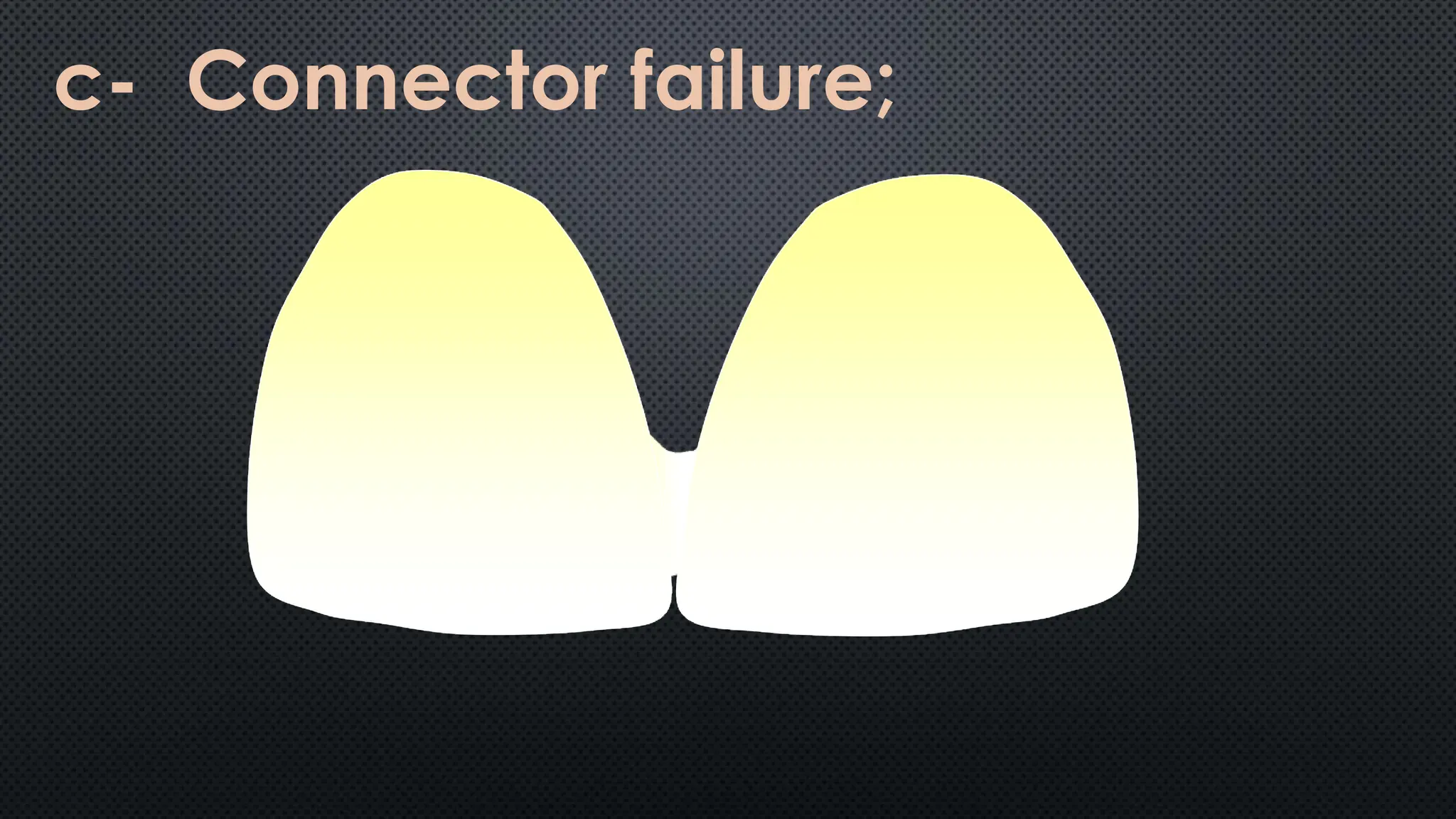 13- failures in fixed prosthesis.pptx sunumu için gerekli | PPTX
