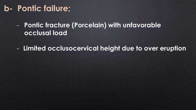 13- failures in fixed prosthesis.pptx sunumu için gerekli | PPT