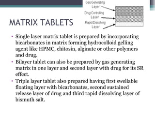 gastro retentive drug delivery system advantages and approaches | PPT ...