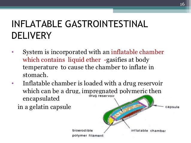 gastro retentive drug delivery system advantages and approaches