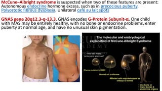 Genetic Diseases & Syndromes Associated With Pituitary Tumors | PPTX
