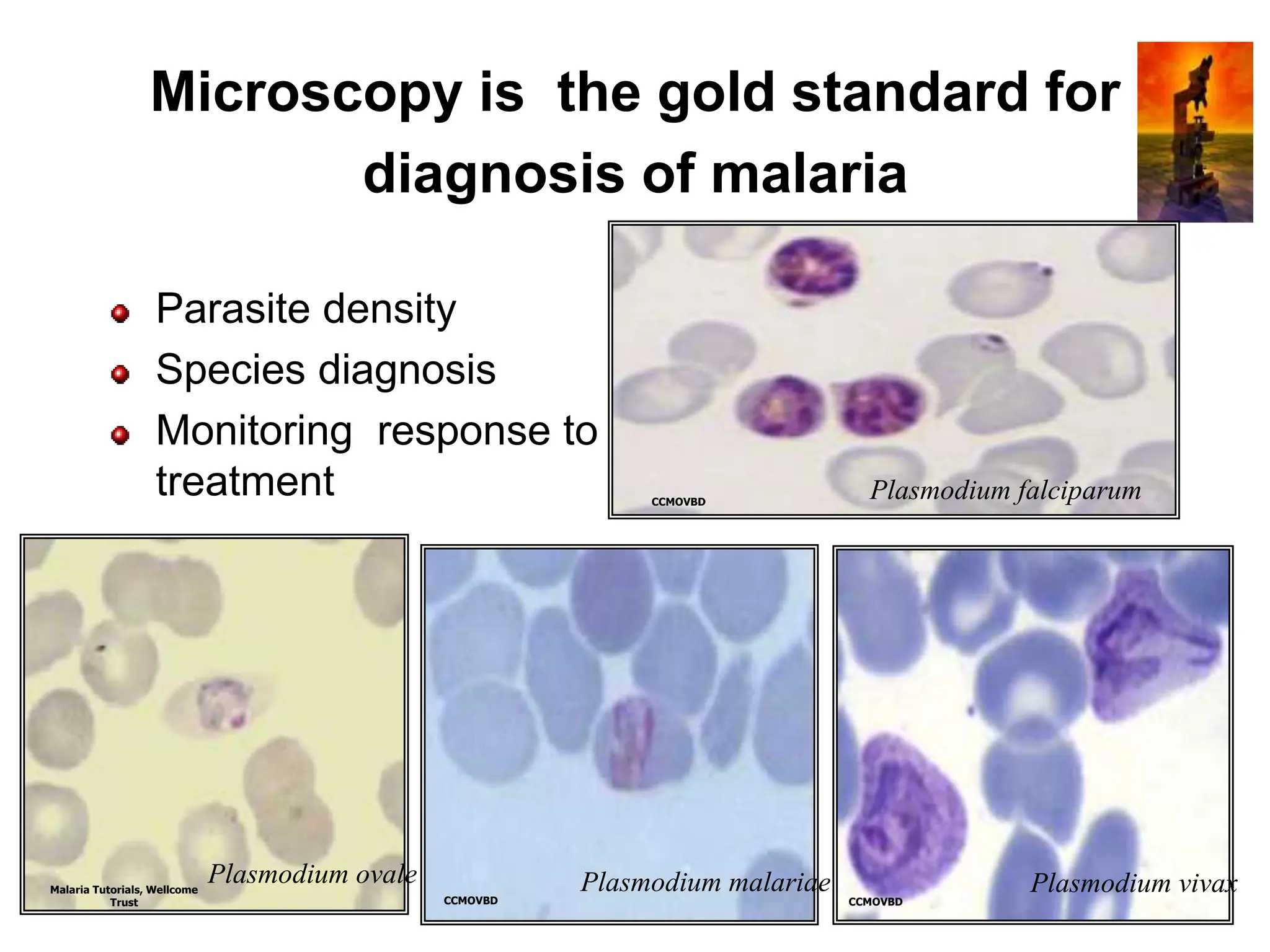 13- malaria.ppt fgjkjjjjjjhwjejejhrhrjieiriri | PPT