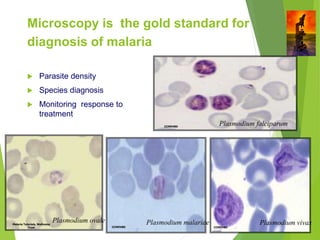 13- malaria.ppt