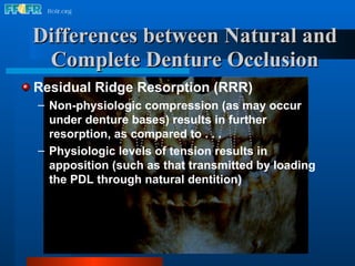 13.natural vs. complete centure occlusion | PPT