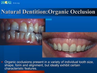 13.natural vs. complete centure occlusion | PPT
