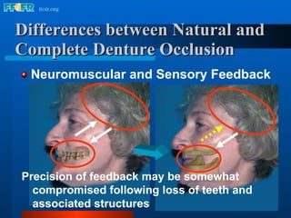 13.natural vs. complete centure occlusion | PPT