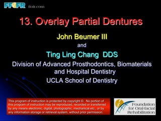 13.overlay rpd’s | PDF