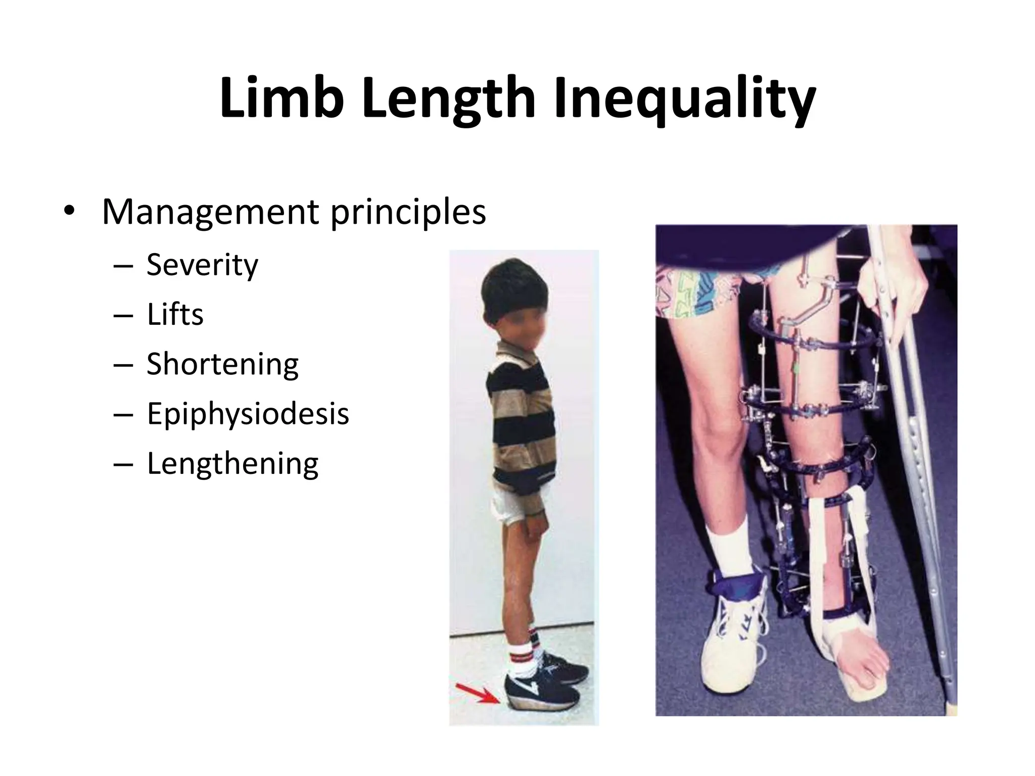 13-pediatric common lower limb disorders.ppt