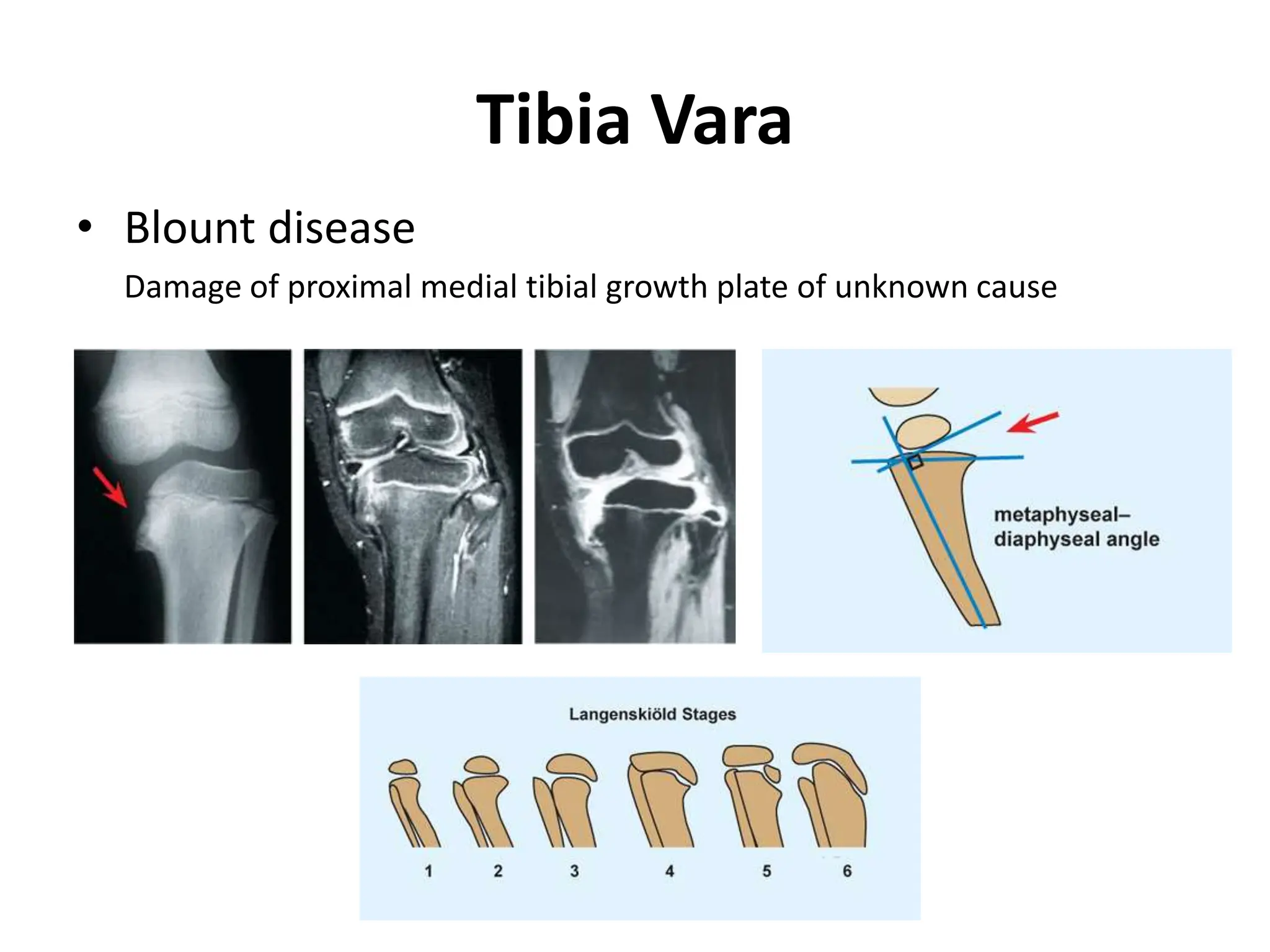 13-pediatric common lower limb disorders.ppt