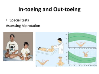 13-pediatric common lower limb disorders (1).ppt