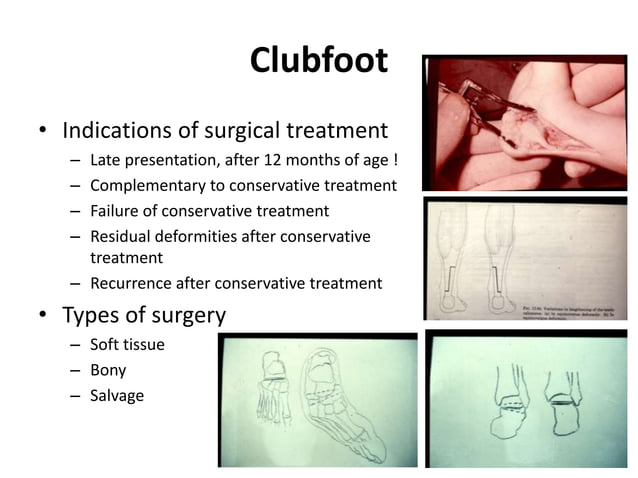 13-pediatric common lower limb disorders (1).ppt