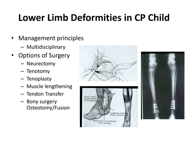 13-pediatric common lower limb disorders (1).ppt