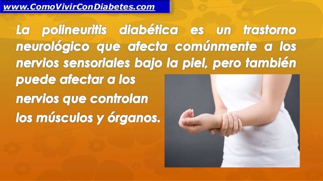 Polineuritis Diabética