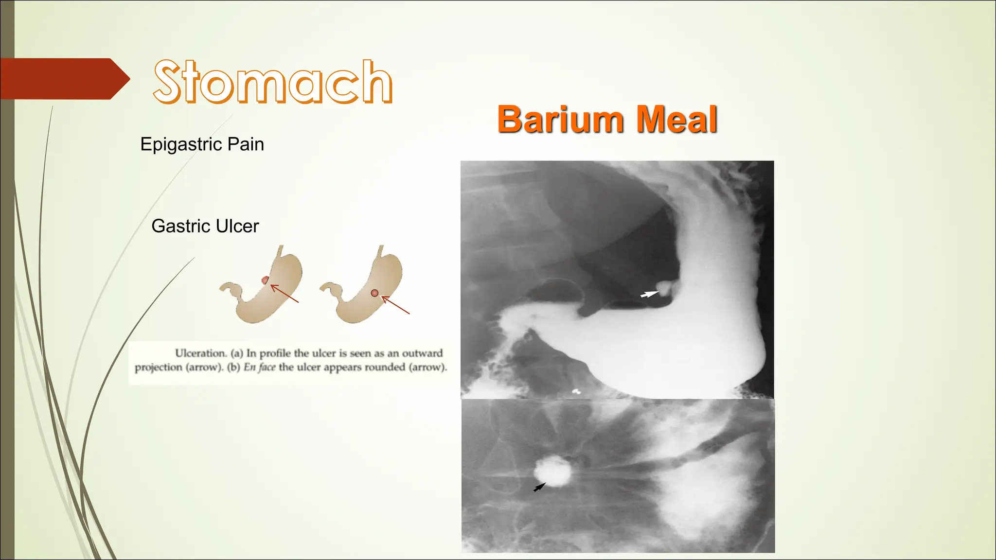 13- RADIOLOGY DISEASES OF GASTROINTESTINAL TRACT.pdf