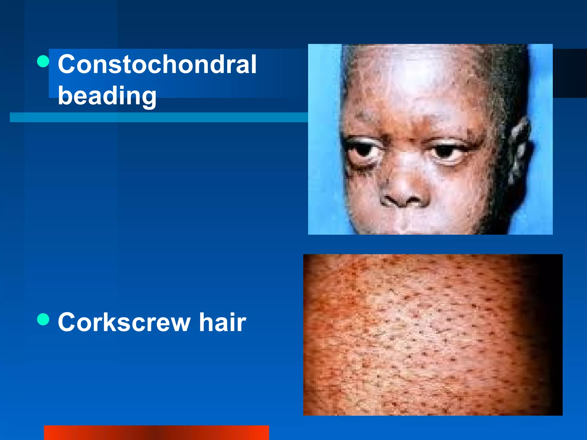 scurvy ~cabigas | PPT | Nutrition | Healthy Living