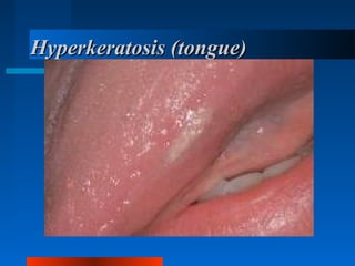 scurvy ~cabigas | PPT | Nutrition | Healthy Living