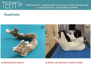 Processesing and additive manufacturing of bones for the teaching of ...