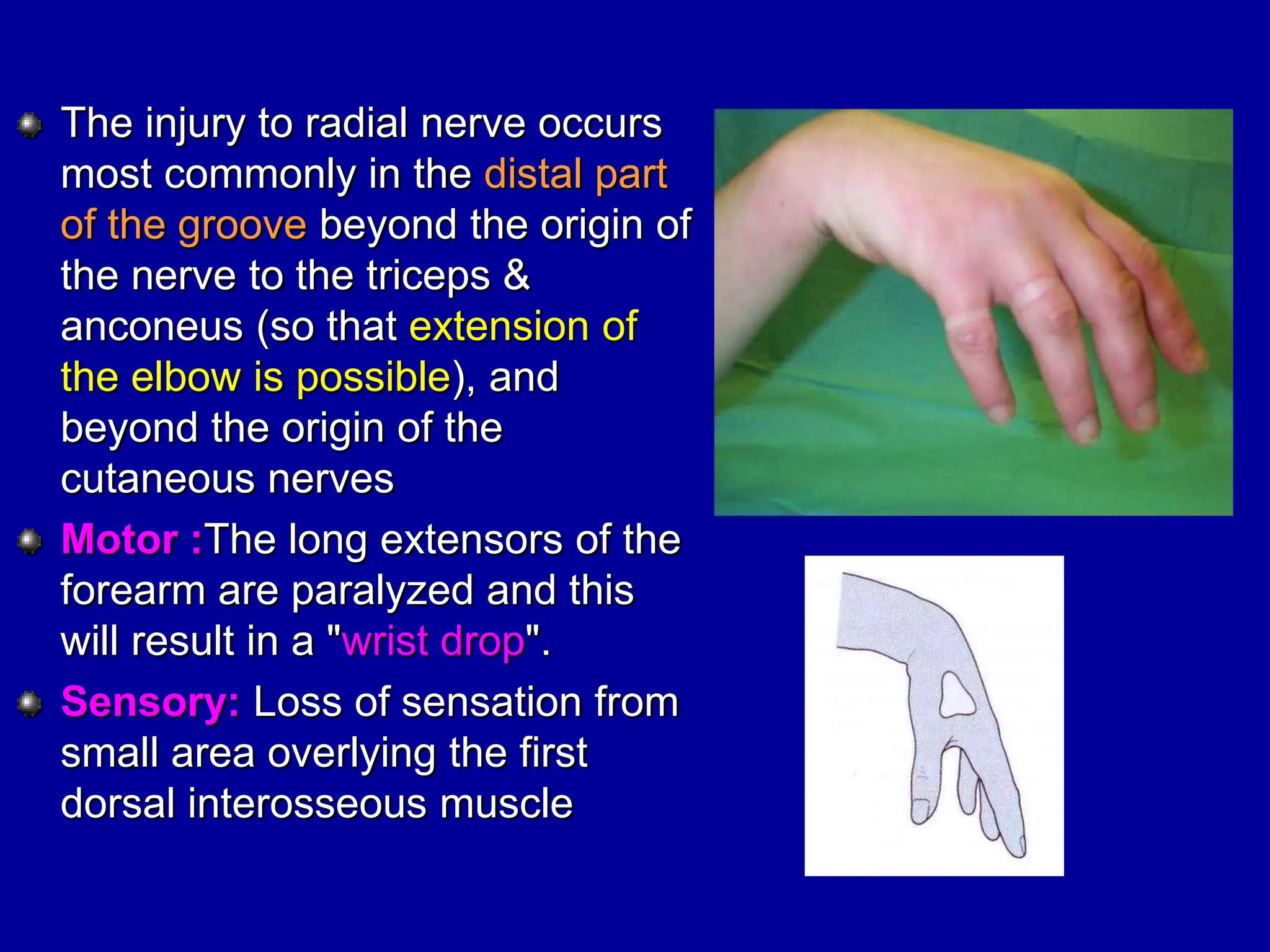 13 - Upper limb nerve injuries.ppt