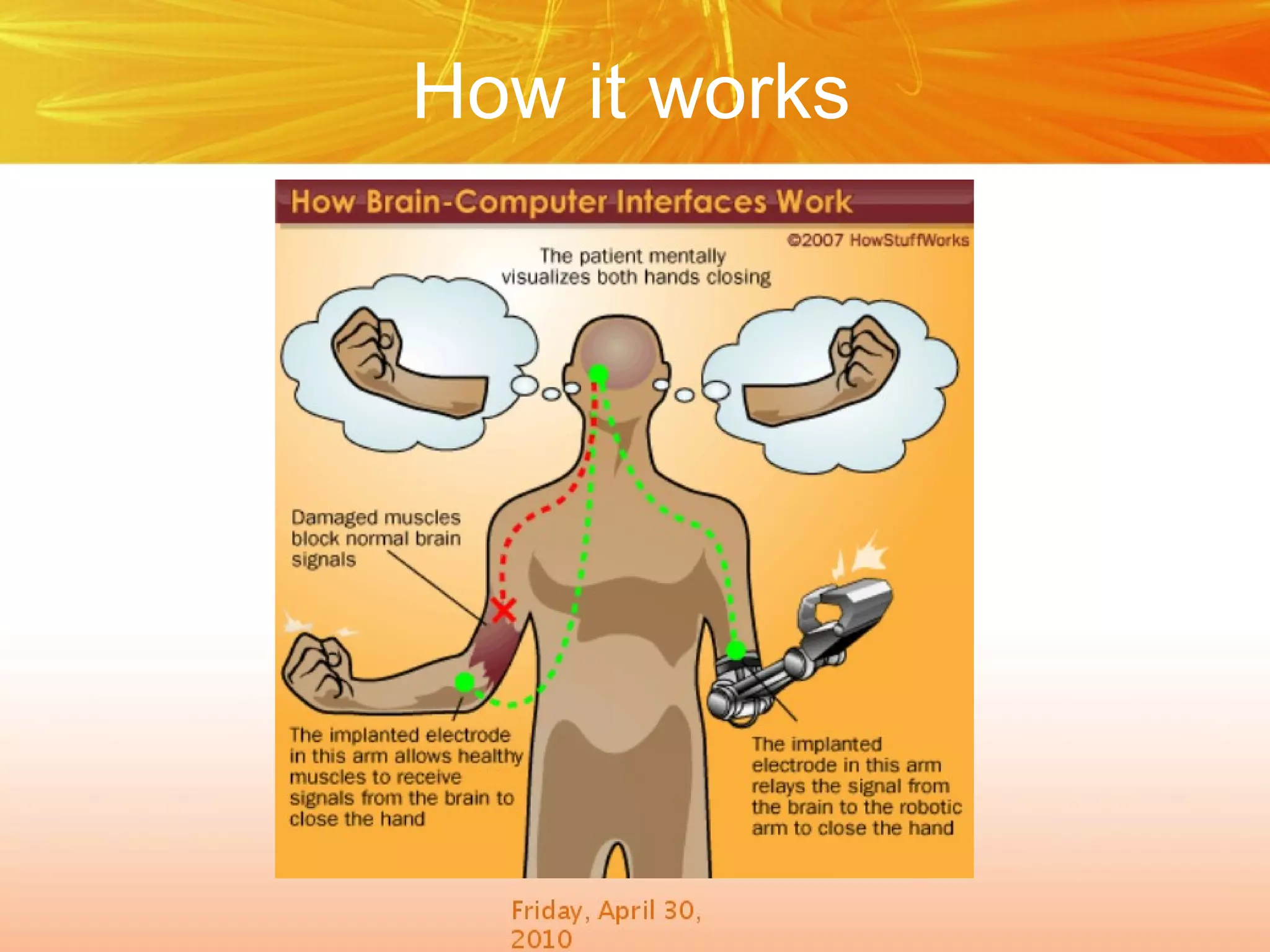 brain computer-interfaces PPT | PPT | Brain and Nervous System Disorders | Diseases and Conditions